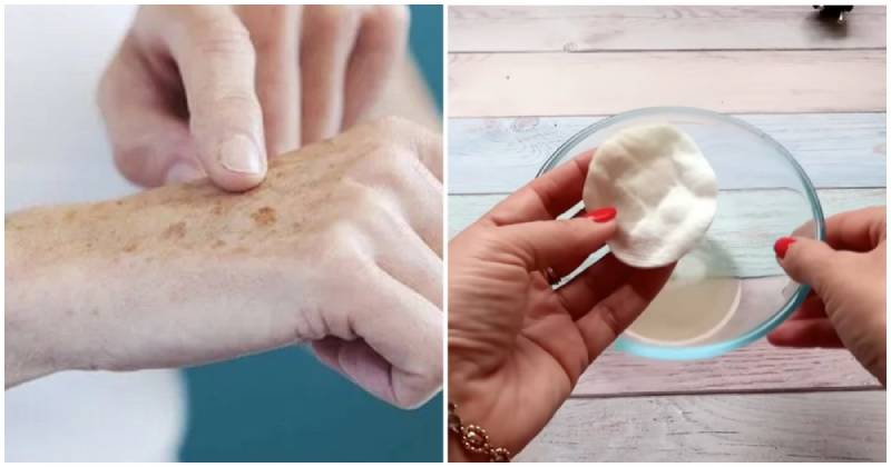 Un sfat vechi pentru a lumina și reduce petele pigmentare - Recete Usoare